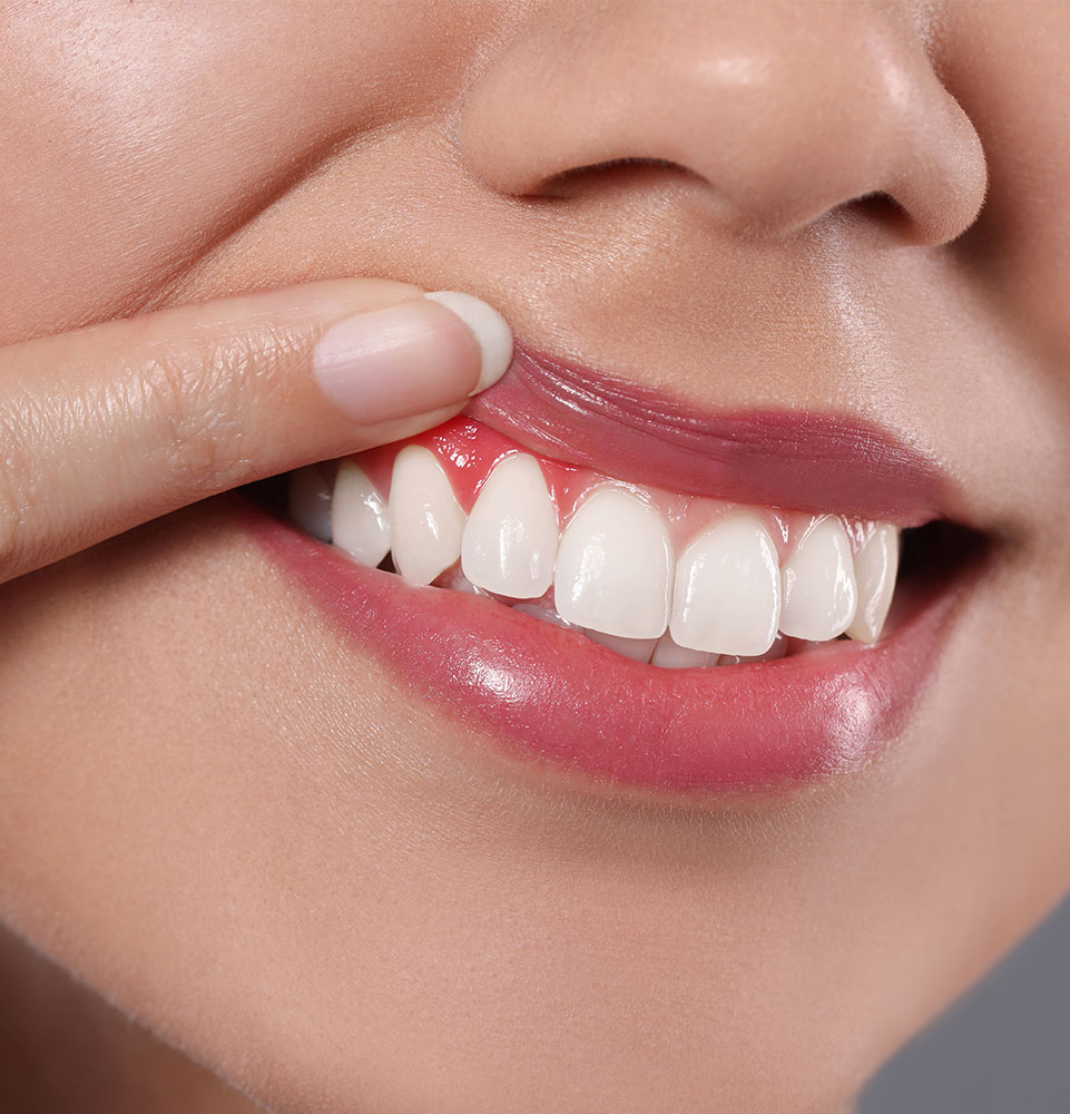 Gum Disease Treatment | Hazlet, NJ | Glenwood Dental Group