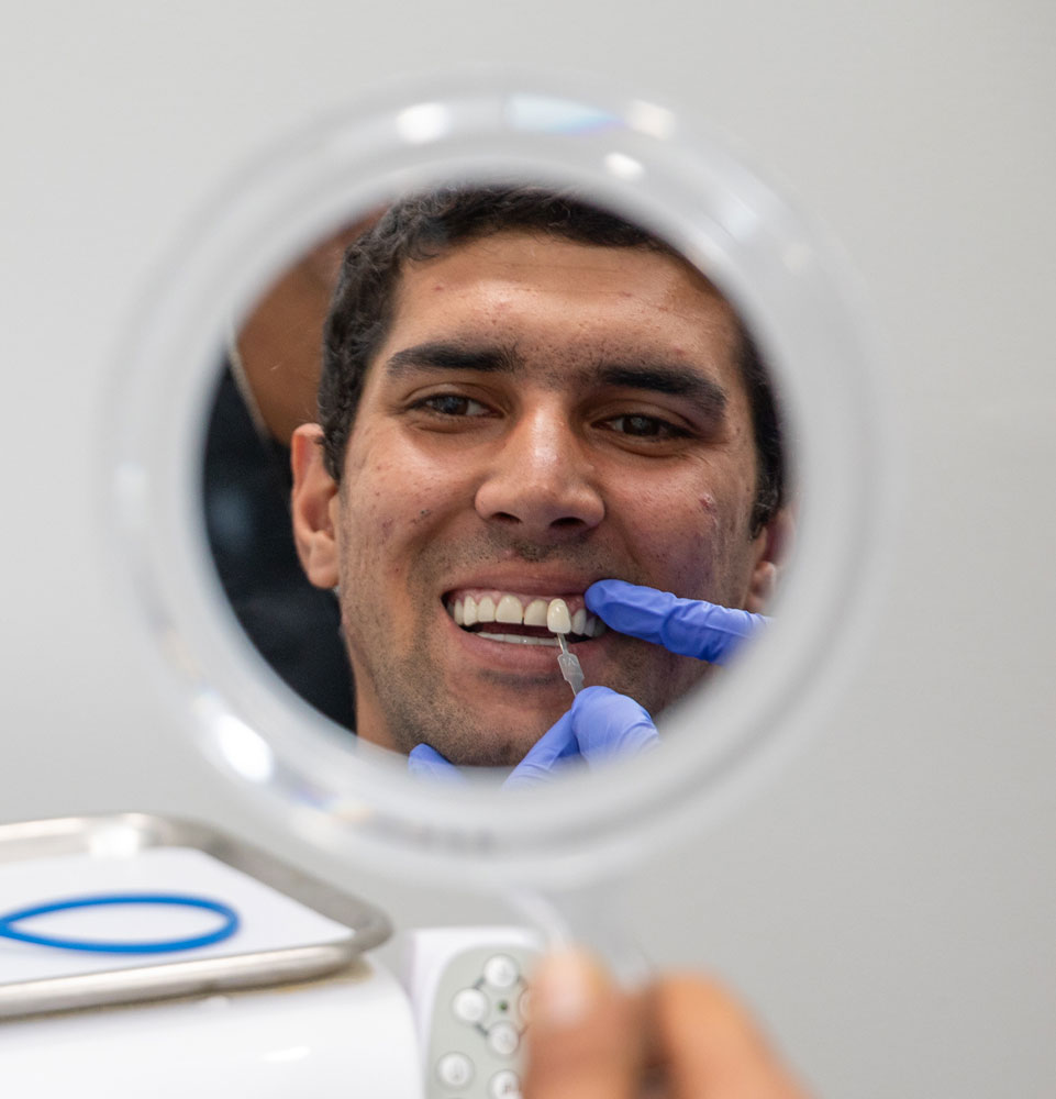 Porcelain Veneers | Hazlet, NJ | Glenwood Dental Group